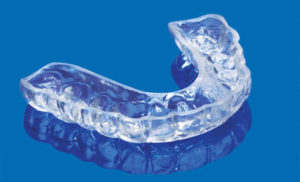 Carefree Dentists | Dental Night Guard (Occlusal Guard) Instructions